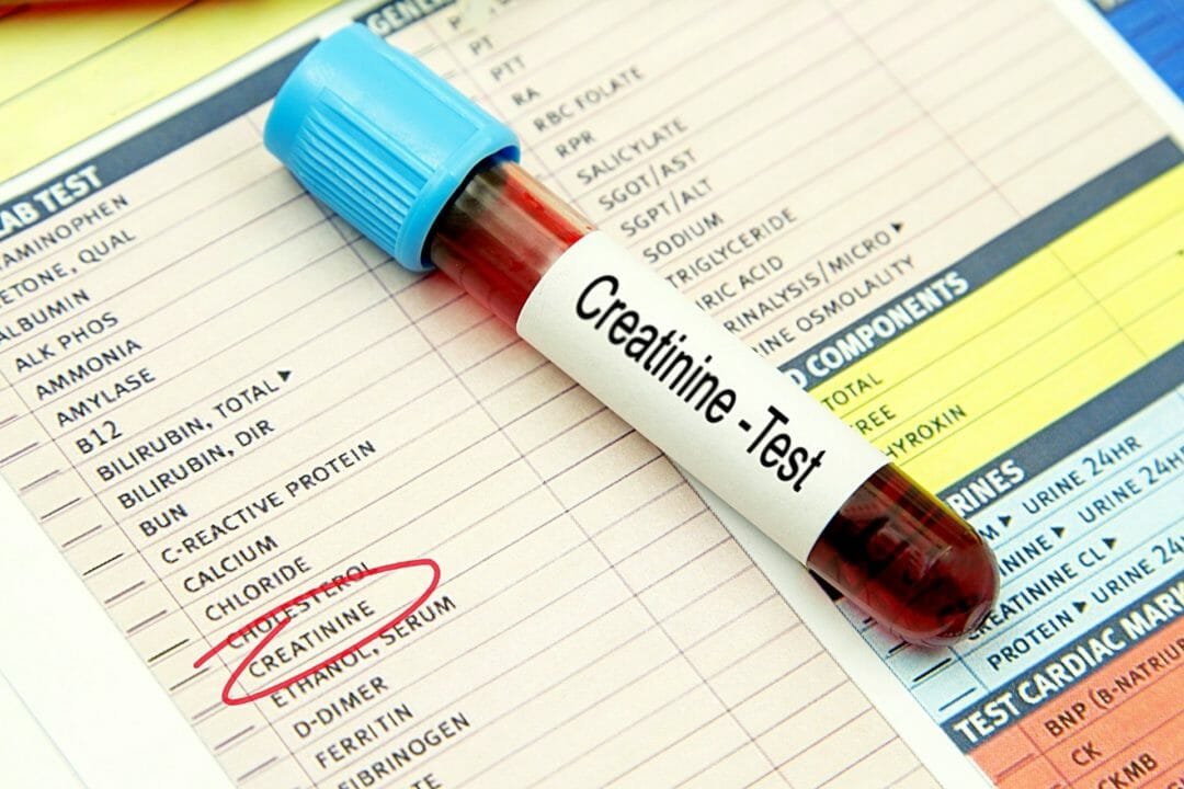 Serum Creatinine: A Complete Guide to Its Importance in Health!